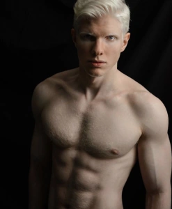 Bera | Wiki Albinisme | Fandom