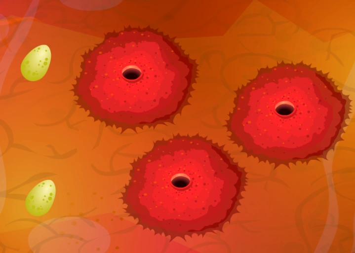 Bugeater Peter | Amateur Surgeon Wiki | Fandom