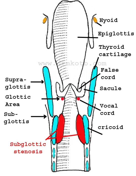 User blog:XCrazyCatLadyx/Subglottic Stenosis | Animal Groups Roleplay ...