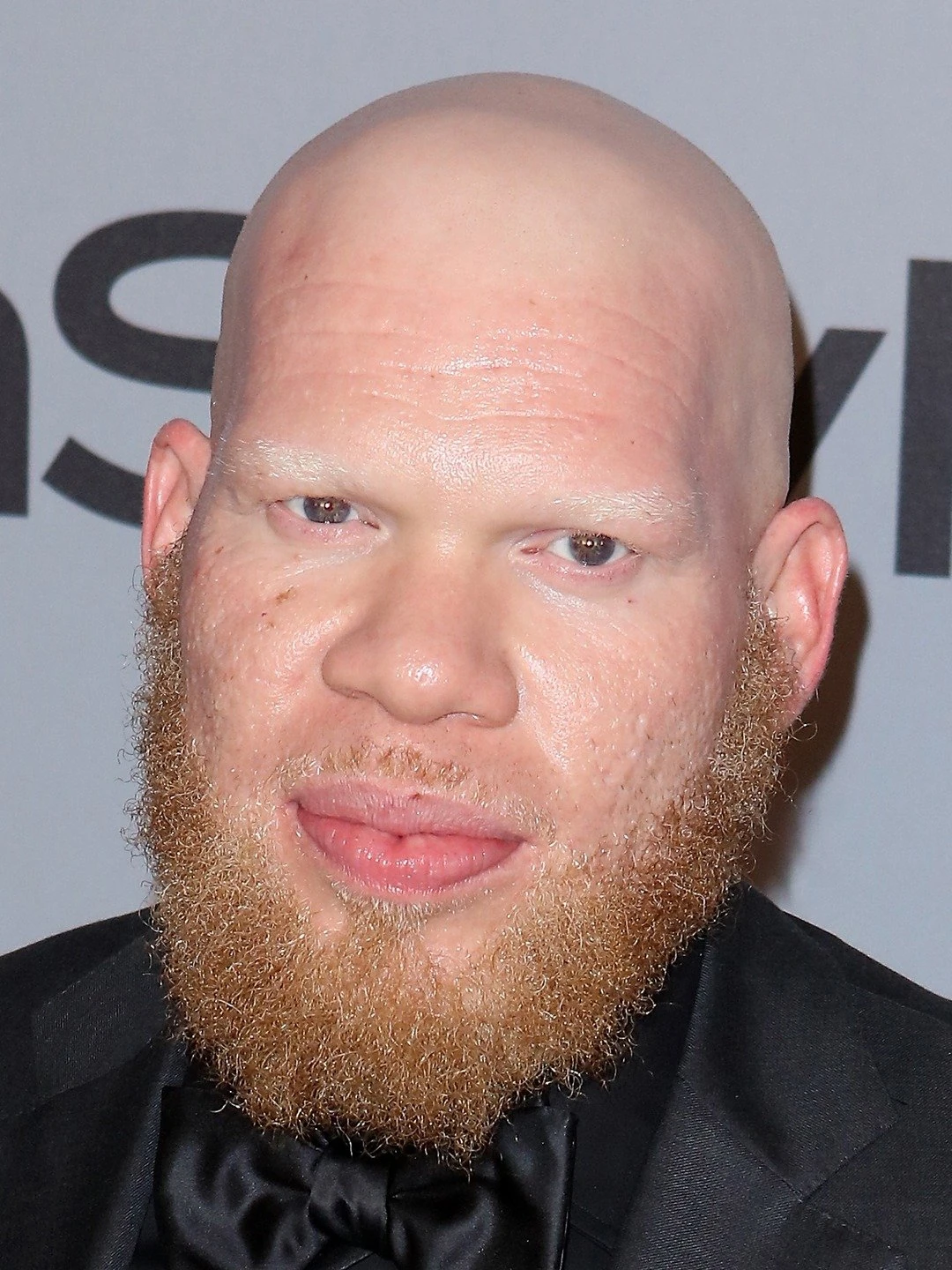 Marvin "Krondon" Jones III | Black-Lightning (TV series) Wiki | FANDOM ...