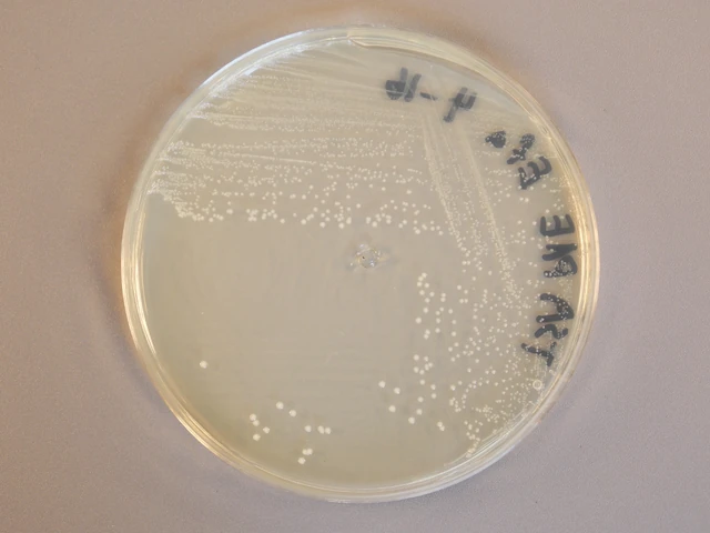 Image - Enterococcus faecalis.JPG | Classroom Bacterial Identification ...