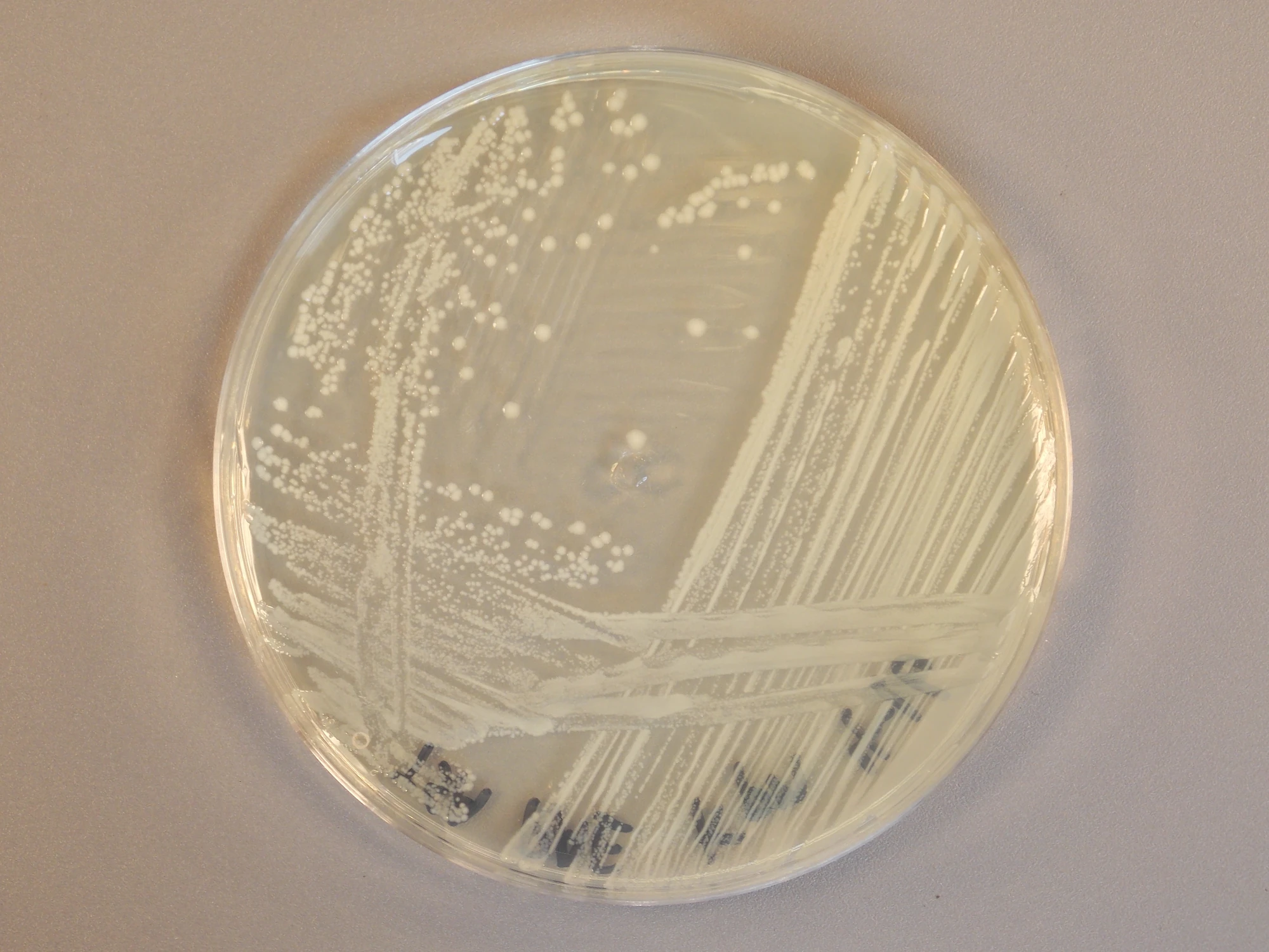 Image - Klebsiella pneumonia.JPG | Classroom Bacterial Identification ...