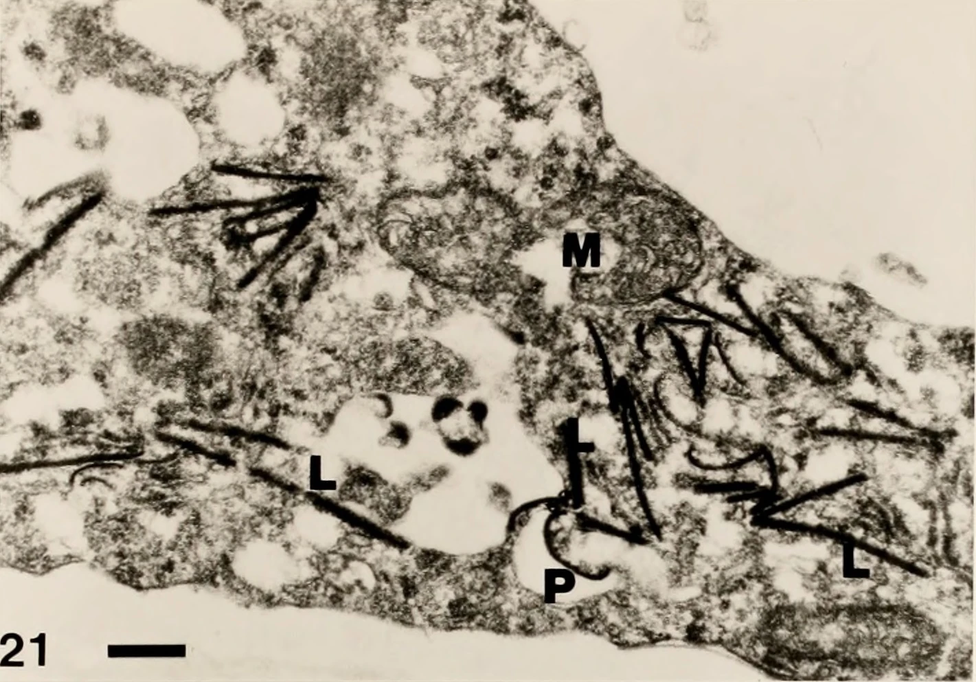 SCP-3105 | Wiki Creepypasta | Fandom
