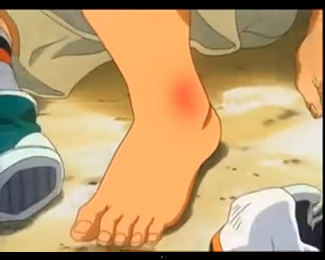 Image - Sprained Ankle.jpg | Crush Gear Wiki | FANDOM powered by Wikia