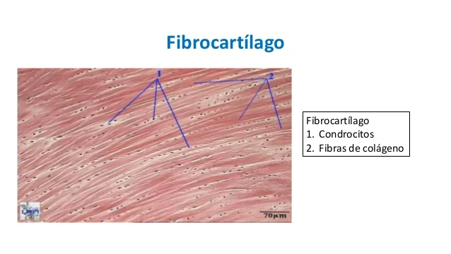 FIBROCARTÍLAGO | Enciclopediamesomedicina Wikia | Fandom