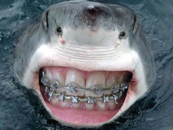 Image - Funny-sharks-with-human-teeth-braces-pics-images-photos-15.jpg ...
