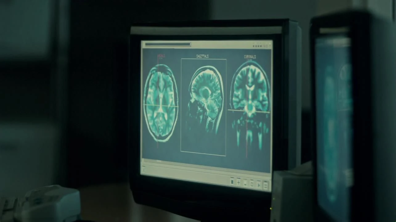 Encephalitis | Hannibal Wiki | Fandom