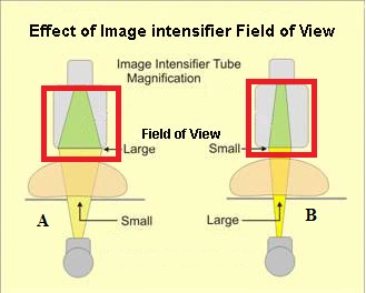 Field of View, X-ray | HTM Wiki | FANDOM powered by Wikia