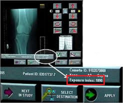 Exposure Index | HTM Wiki | FANDOM powered by Wikia