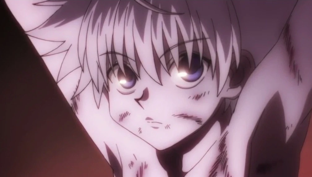 Image - Killua tortured 2.jpg | هانتربيديا | FANDOM powered by Wikia
