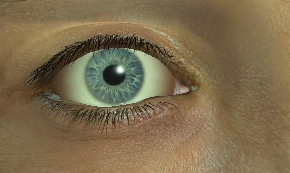 Image - Elliot's eye.JPG | Lostpedia | FANDOM powered by Wikia Image - Elliot's eye.JPG | Lostpedia | FANDOM powered by Wikia