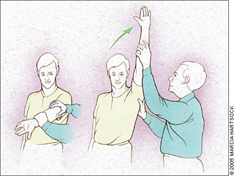 Test de Neer | Medicina Wiki | FANDOM powered by Wikia