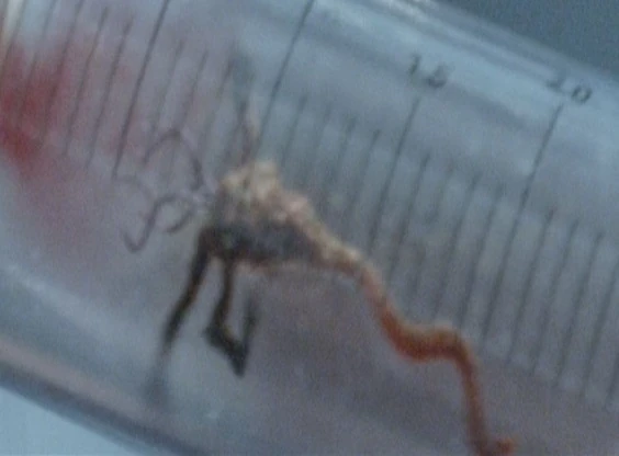 Las Plagas (RE films) | Monster Wiki | Fandom