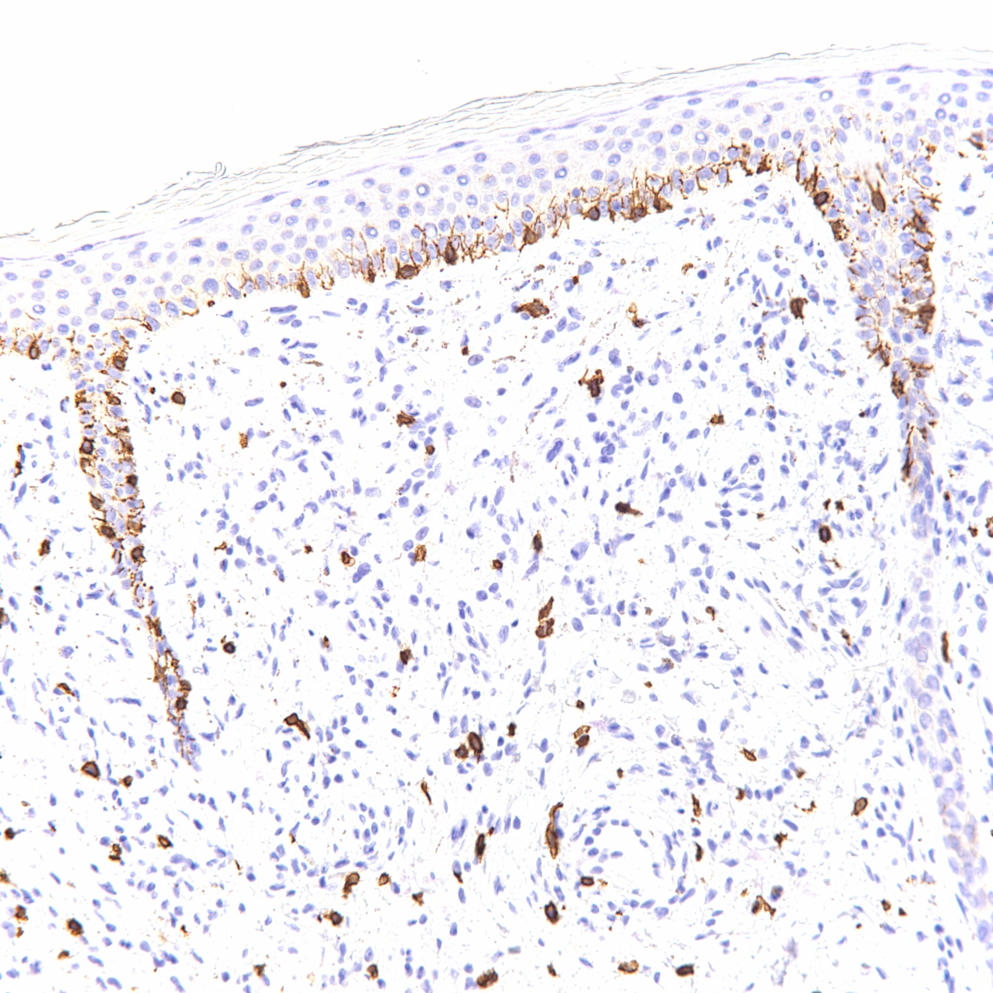Image - CD117.melanocytes.normal..jpg | Pathology Resident Wiki ...