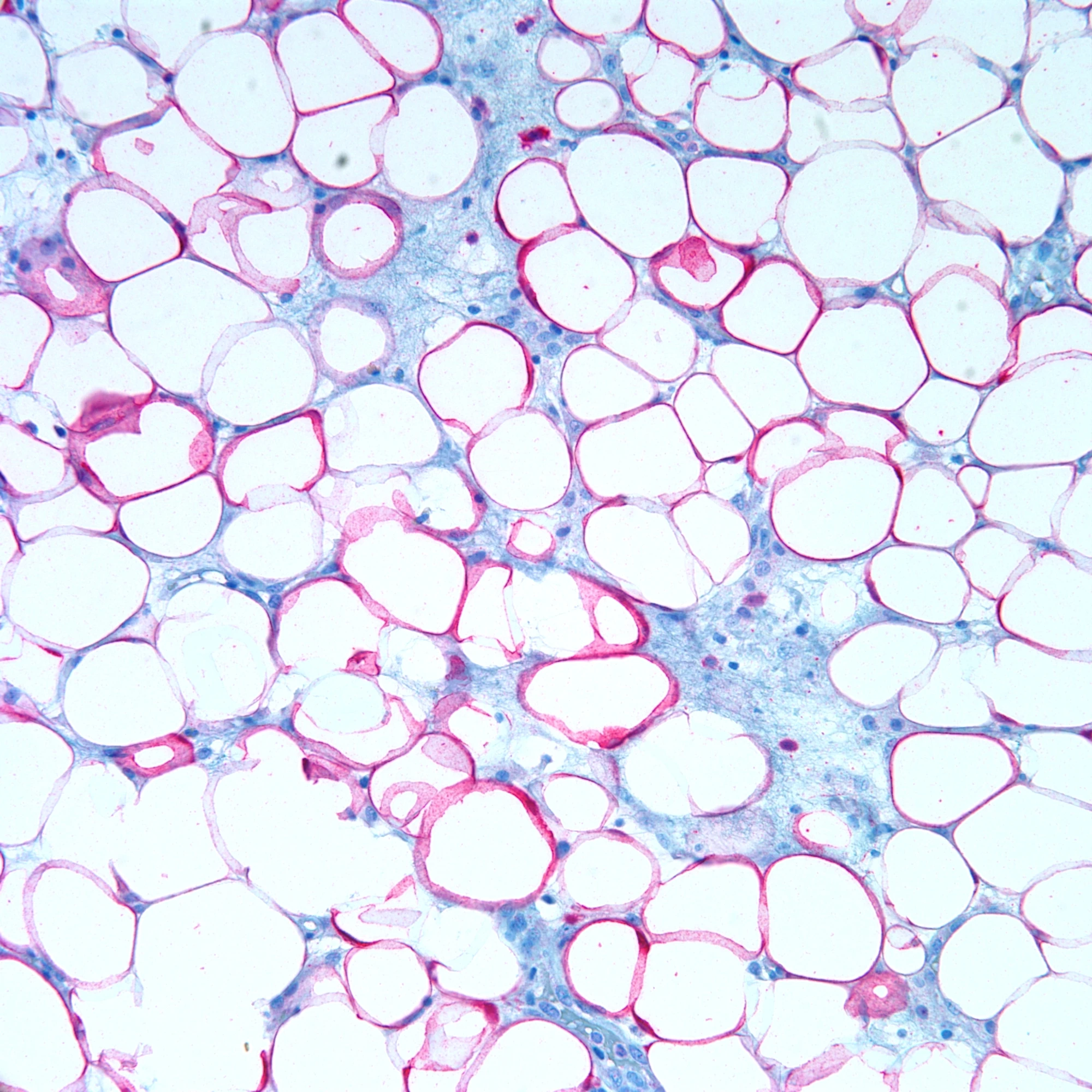 Adipose Connective Tissue Labeled Diagram How To Draw Adipos