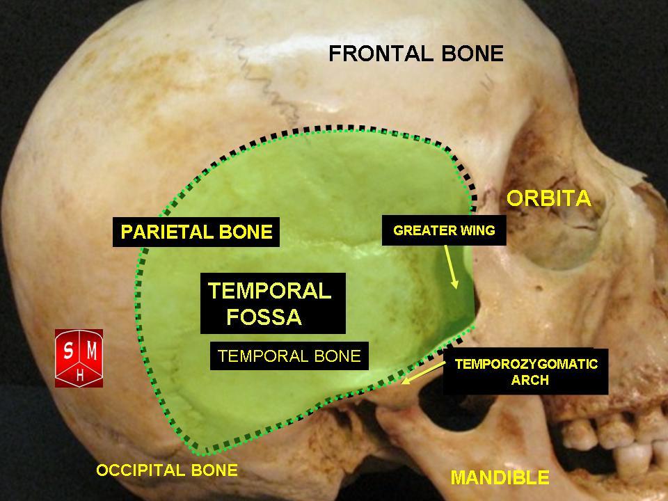 Temporal Fossa Ranzcrpart1 Wiki Fandom Powered By Wikia