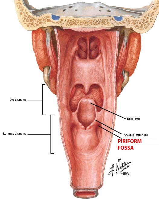 Larynxpyriform Recesssinusfossa Ranzcrpart1 Wiki Fandom Powered By Wikia