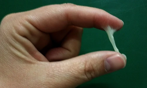 Image - Moco cervical.jpg | SaludPublicaA3 Wiki | FANDOM powered by Wikia