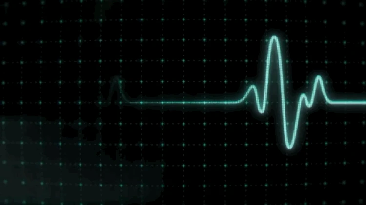 Image - EKG (These always make me nervous).gif | The Amazing World of ...
