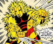 Porcupine (Marvel) | Villains Wiki | Fandom