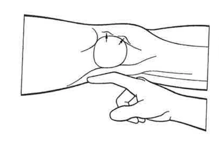 Signe du flot | Wikige Wiki | Fandom